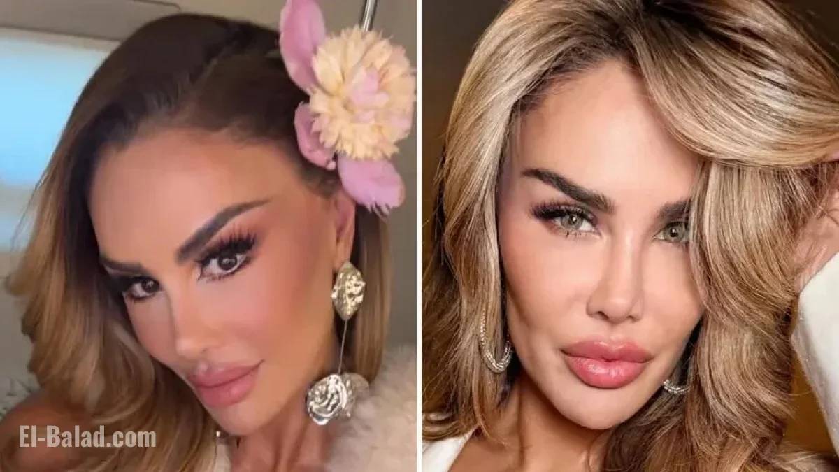 Ninel Conde Unveils New Eye Color After Surgery: See Her New Look - El ...