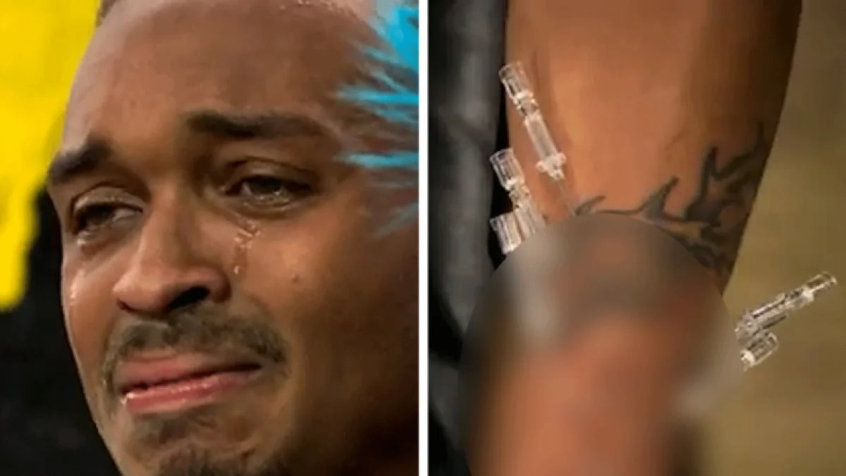 ‘Fear Factor’ Contestant Endures 11 Needles in Intense Clip - El-Balad.com